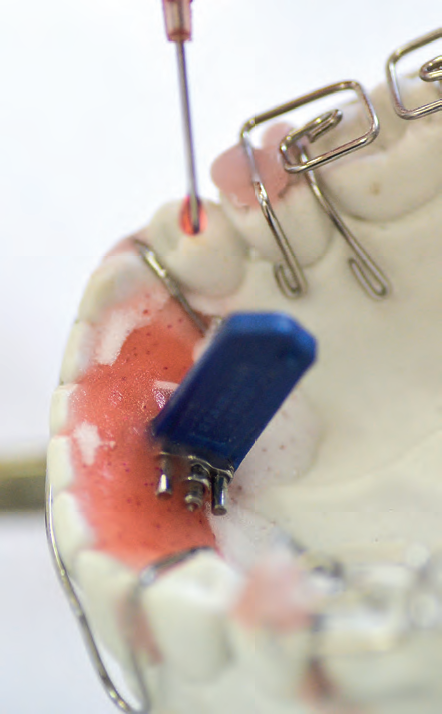 Kinetor Stockfischa – aparat niedoceniony i zapomniany